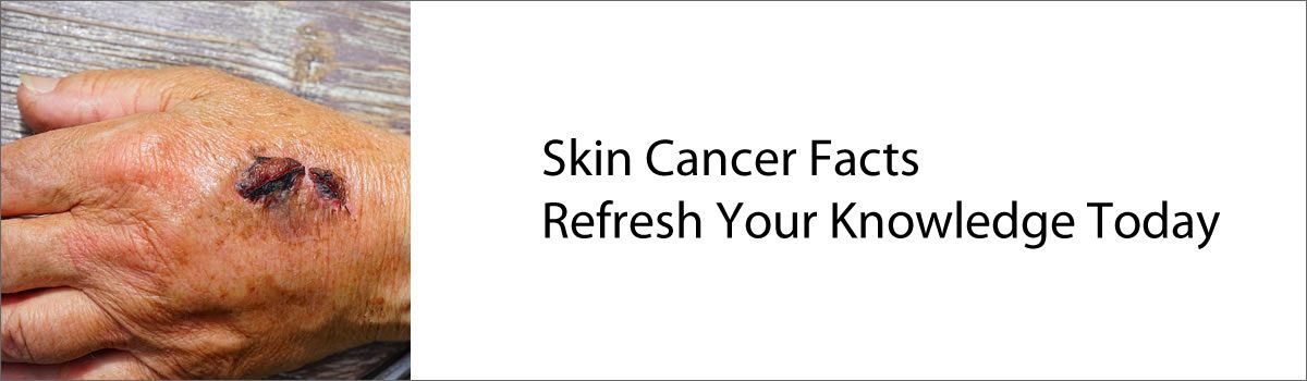 Skin Cancer Prevention – The Uvoider Blog | Protect Your Skin From The Sun